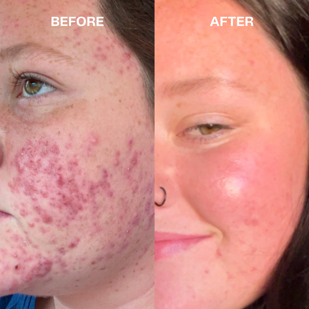 The Bestsellers – Hey Bud Skincare